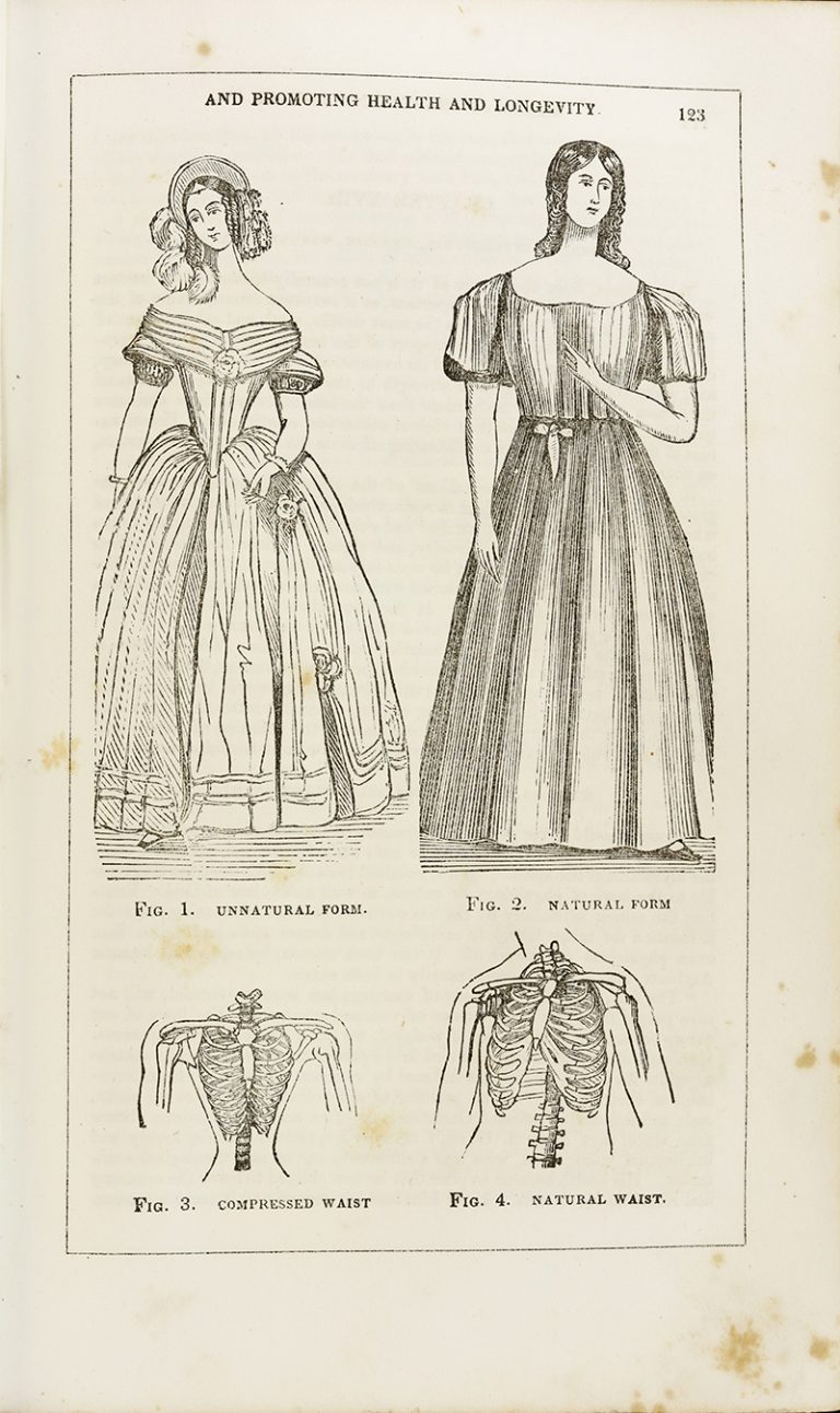 Suffering for Beauty – Becker Medical Library